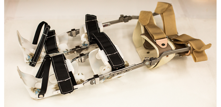 Pediatric Orthotic Specialists: Peds Abduction Brace & More